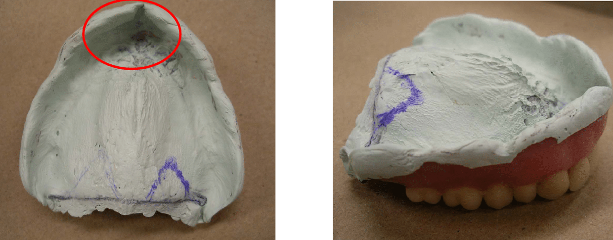 Cavex Outline: eugenol-free paste