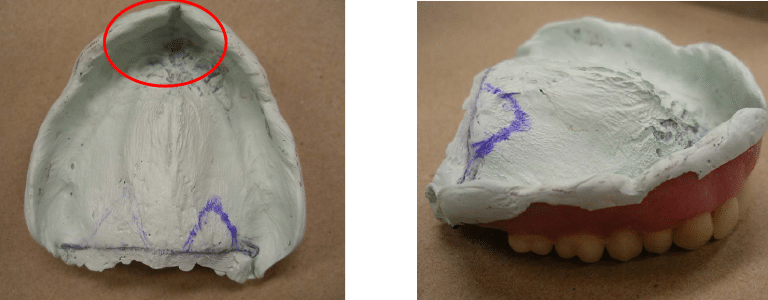 Cavex Outline: eugenol-free paste