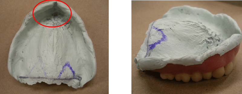 Cavex Outline: eugenol-free paste