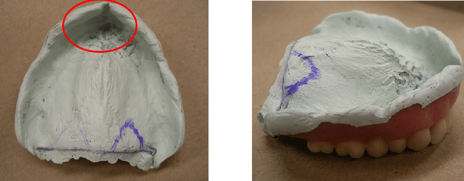 Cavex Outline: eugenol-free paste